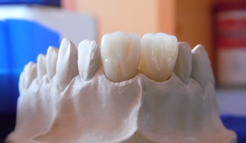 Laborator dentar CDL, Laborator tehnica dentara Sector 1- BUCURESTI